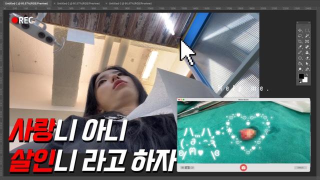 끔찍한 사랑니 vlog | SOOP VOD